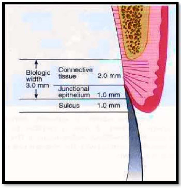 Biologic Width